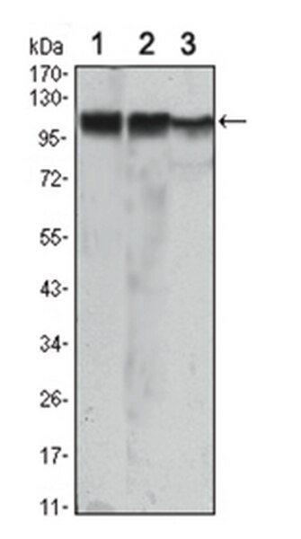 Anti-HK2 Antibody, clone 3D3 | MABN702